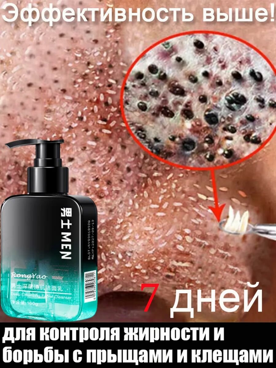Гель для умывания от прыщей/скраб для лица мужской от черных точек, черные точки удаление,160г