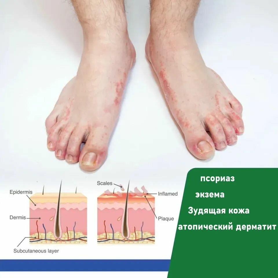 Лечебное средство