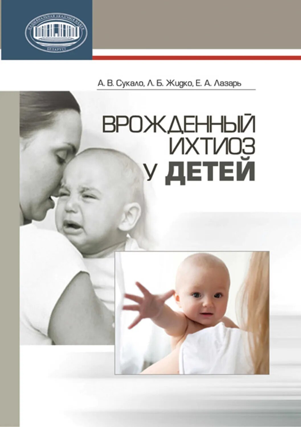 Врожденный ихтиоз у детей [Цифровая книга]