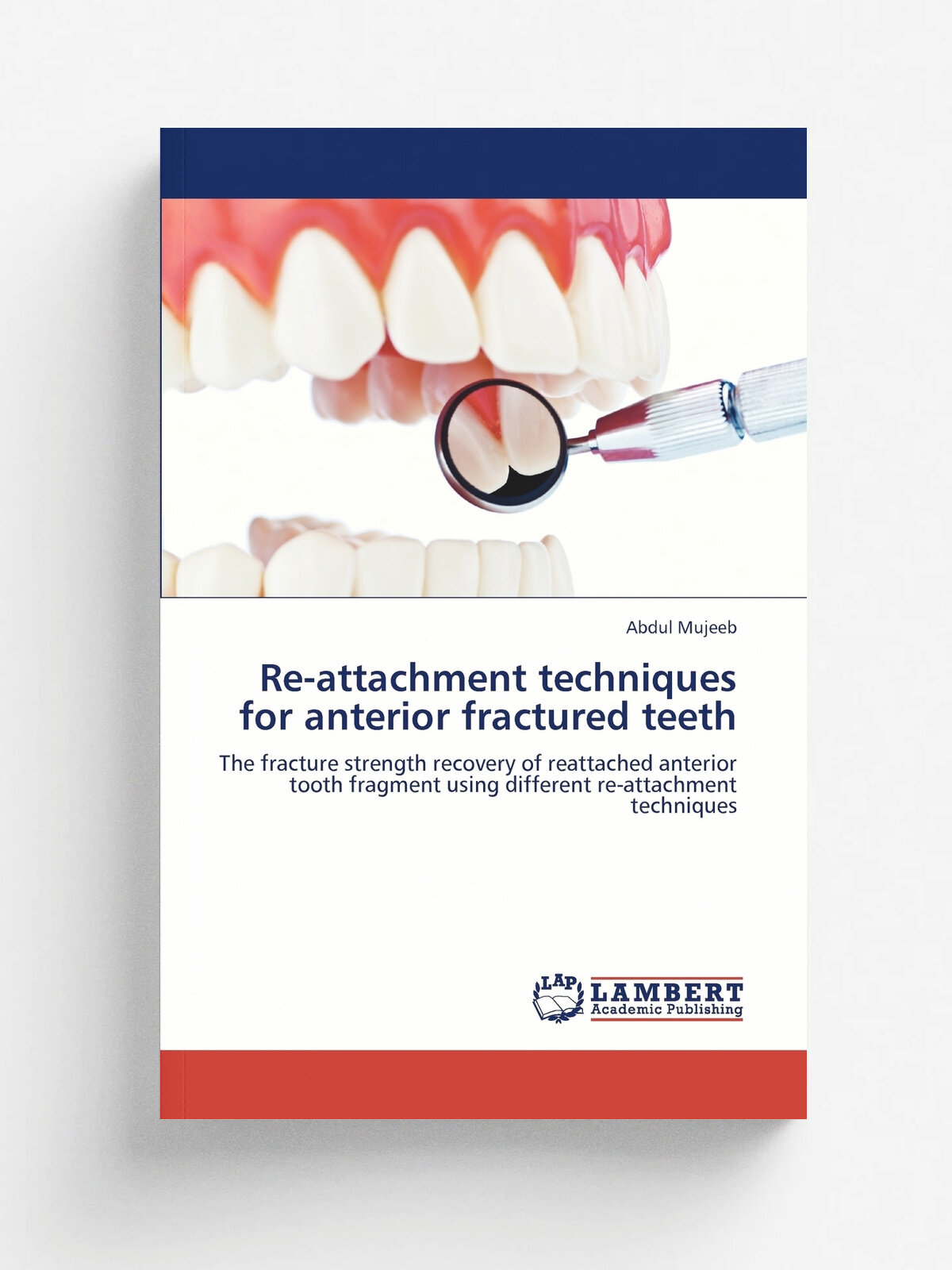 Re-attachment techniques for anterior fractured teeth
