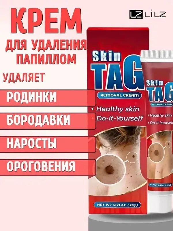 Мазь средство от папиллом и бородавок , гель от прыщей 20 мл. Крем для тела, рук, ног. Антипапиллом