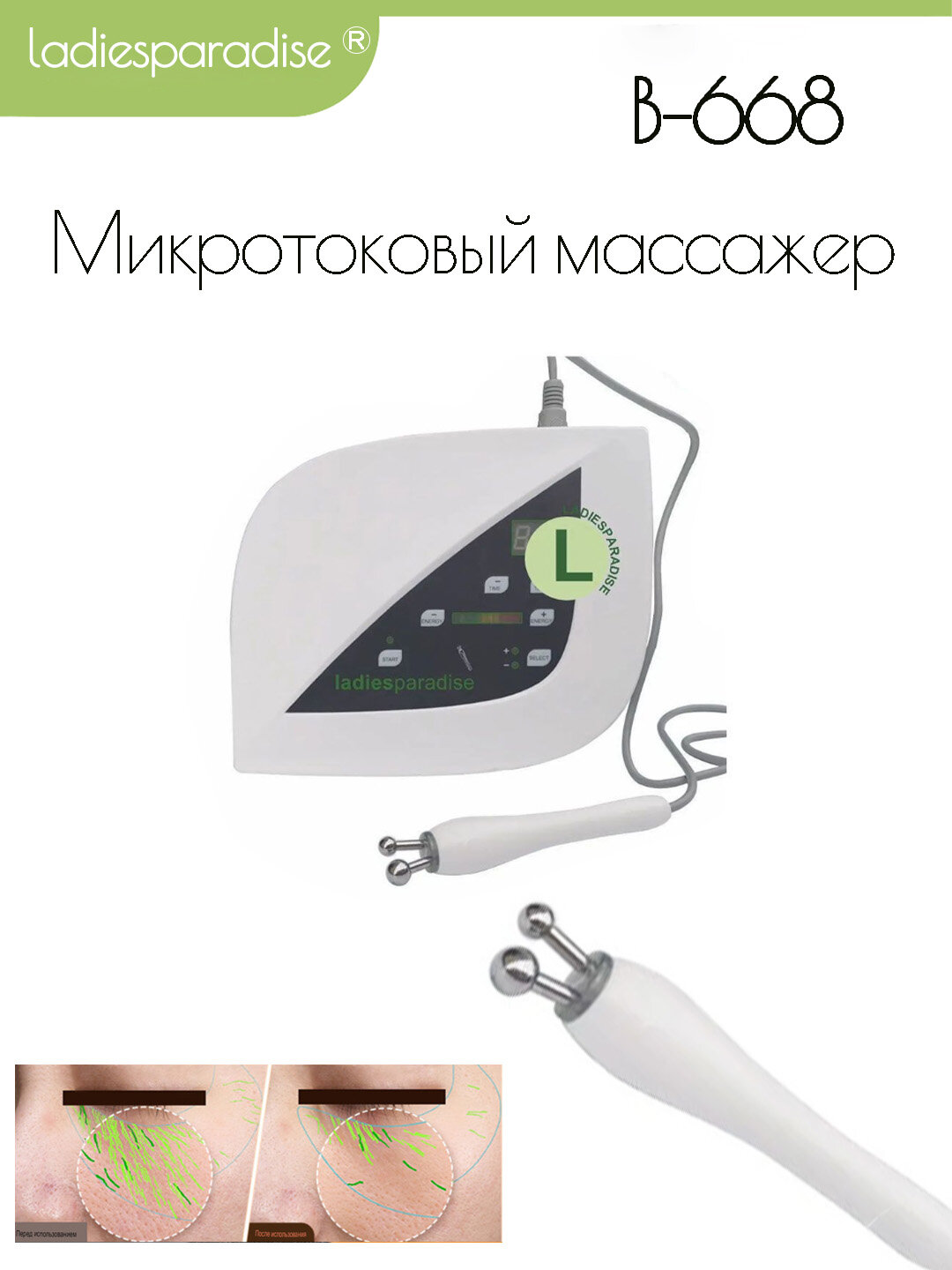 Микротоковый Массажер для Лица LADIESPARADISE B-668, с Массажными Роликами