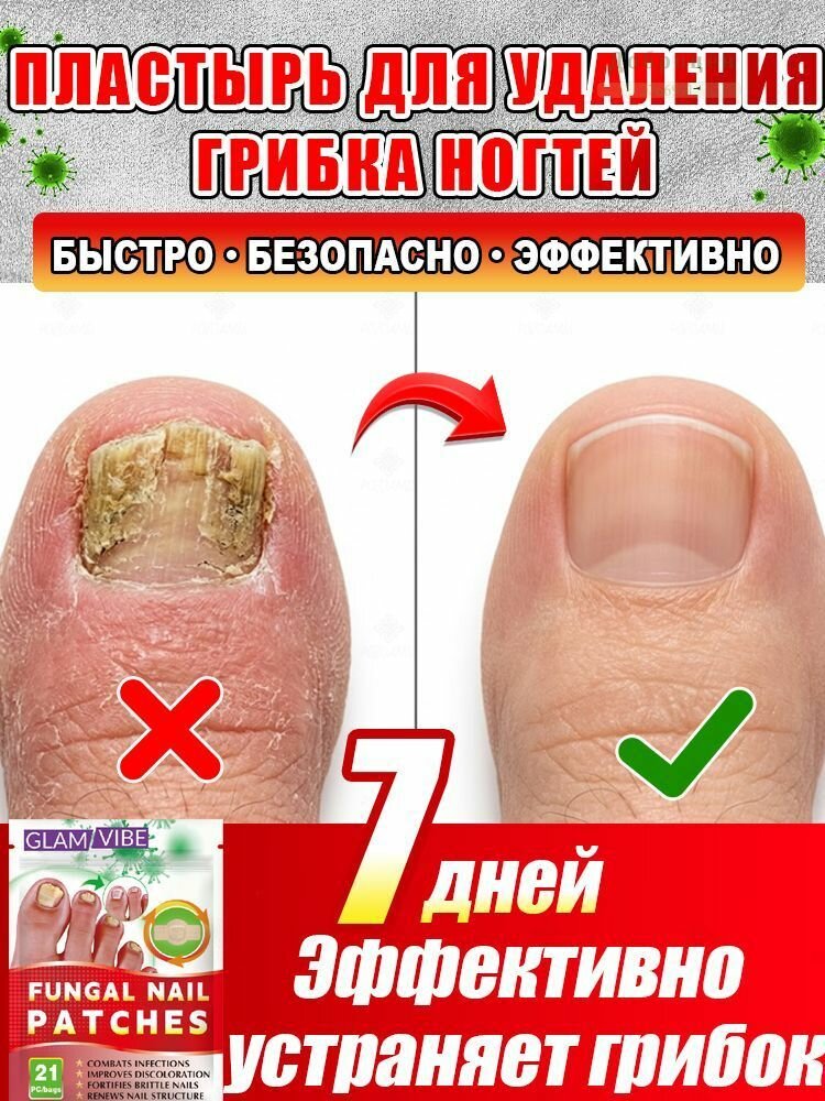 Пластыри от грибка ногтей быстро избавляют от грибковых инфекций рук и ног, а также вылечить утолщение ногтей, покраснение, отек, зуд, расслоение 21шт