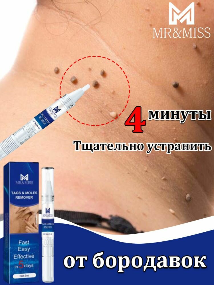 MR&MISS Карандаш от папиллом и бородавок , средство от папиллом, от бородавок, от мозолей, без боли и следов, Без побочных эффектов / 3 мл