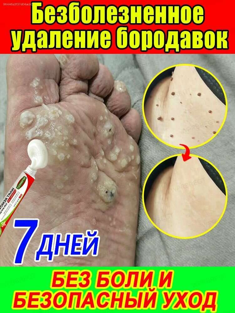 Мазь от бородавок и папиллом - комплексное средство для удаления подошвенных и плоских образований, полное очищение поверхности кожи от наростов, восстановление гладкости , 30 г удаление папиллом и бородавок средство от подошвенных и плоски