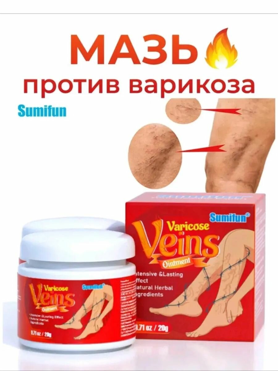 Мазь о варикоза на ногах