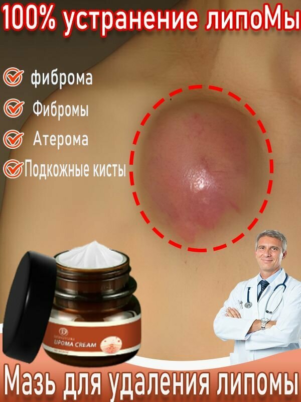 DODOYURI Крем для ухода за кожей с растительными экстрактами, массажный крем для проблемных зон, смягчение и увлажнение кожи, уход за подкожными уплотнениями