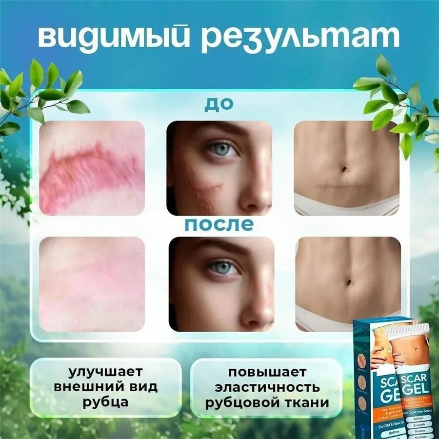 4 шт*30 мл Гель от шрамов, от постакне, крем от шрамов и рубцов, от ожогов, крем от растяжек 30 мл