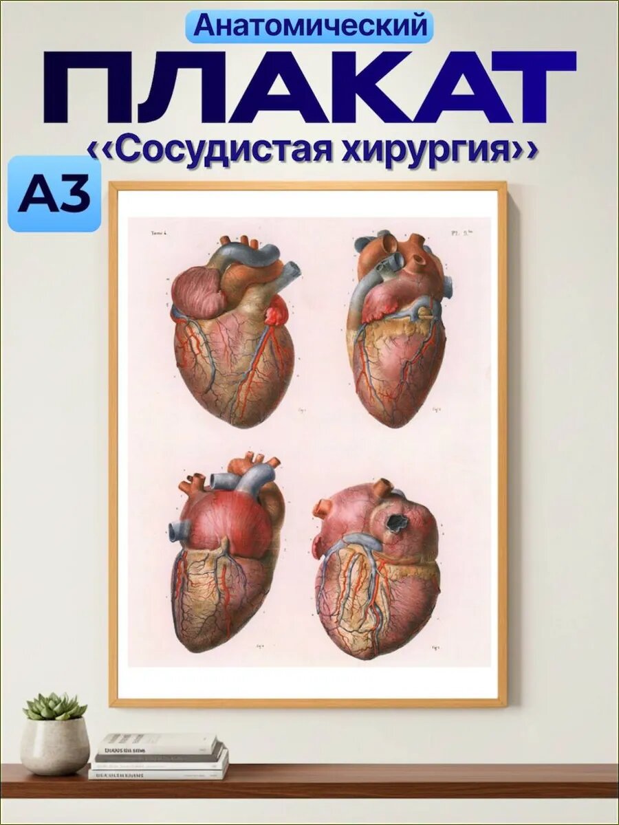 Постер медицинский, сердце, сосудистая хирургия, А3 анатомия, хирургия