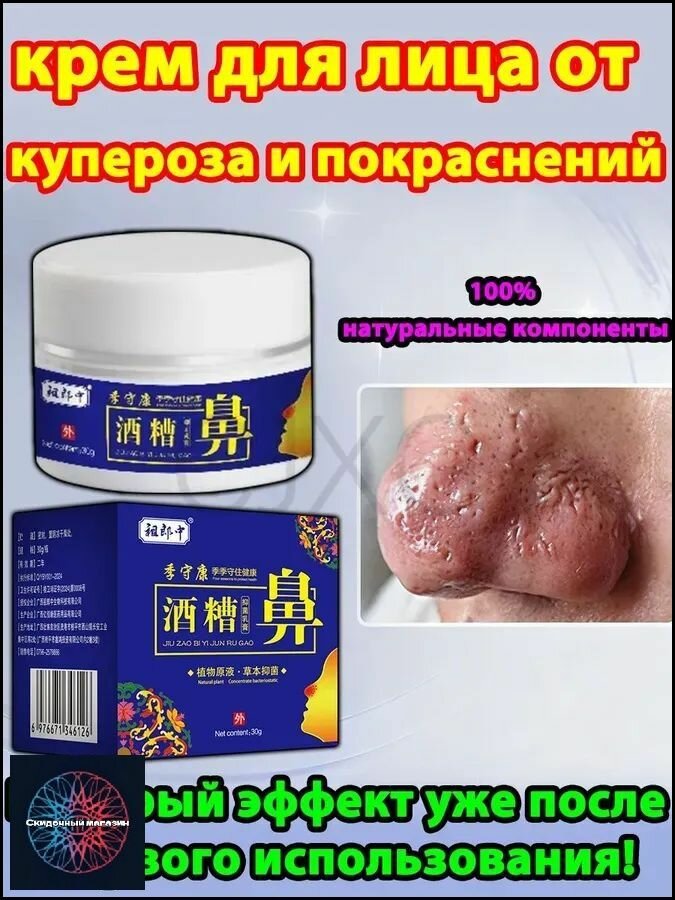 Успокаивающий крем от розацеа 30 гр с премиум составом, гипоаллергенный