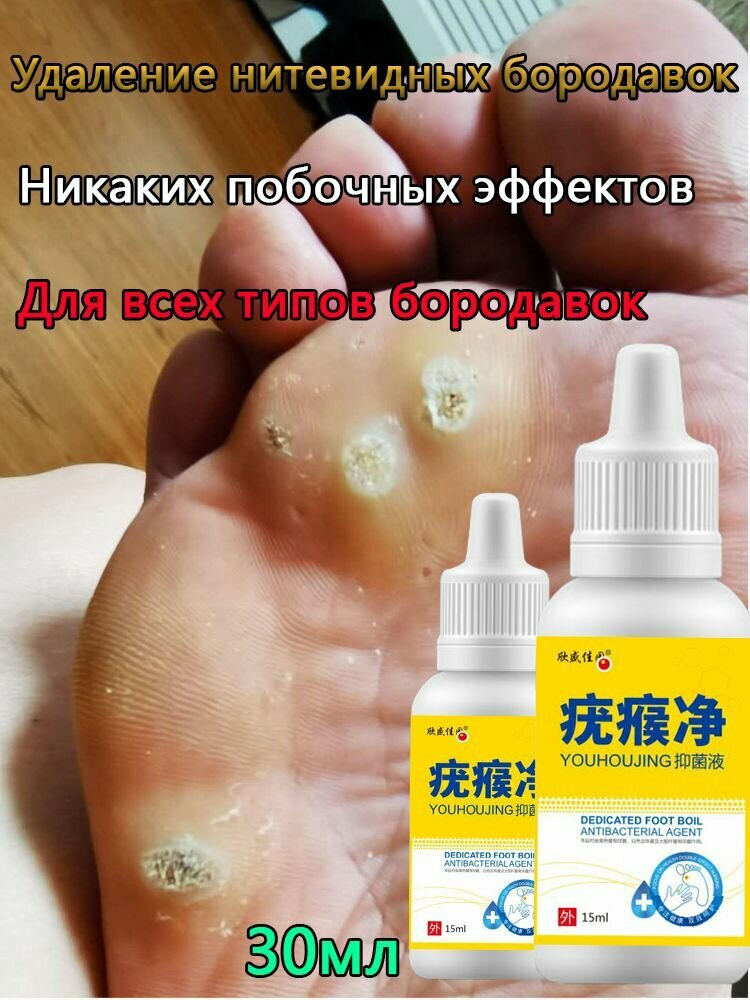Концентрированный крем против папиллом и бородавок Мощная формула для ухода за кожей 30 мл