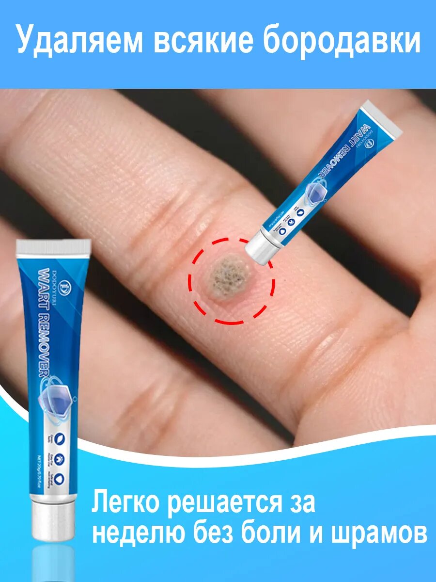 Крем от папиллом и бородавок с натуральными растительными экстрактами, безопасный уход и очищение кожи