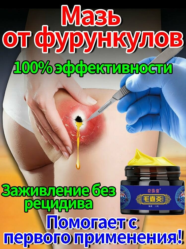 Вытягивающий Мазь от фурункулов, акне и гнойников, Китайская чудо мазь. Быстрый эффект. натуральный состав.30 г