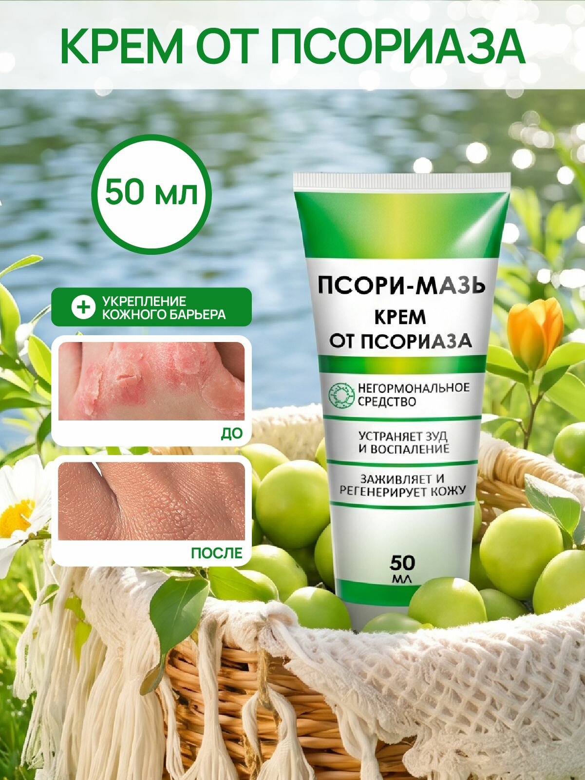 Комплекс от псориаза Псори-мазь, туба 50 мл
