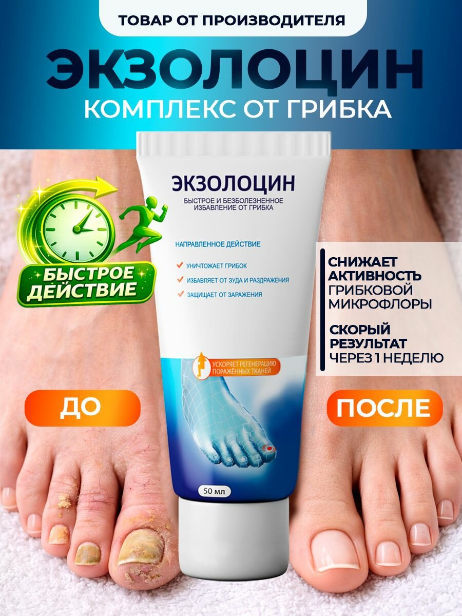 Экзолоцин: крем от грибка ногтей