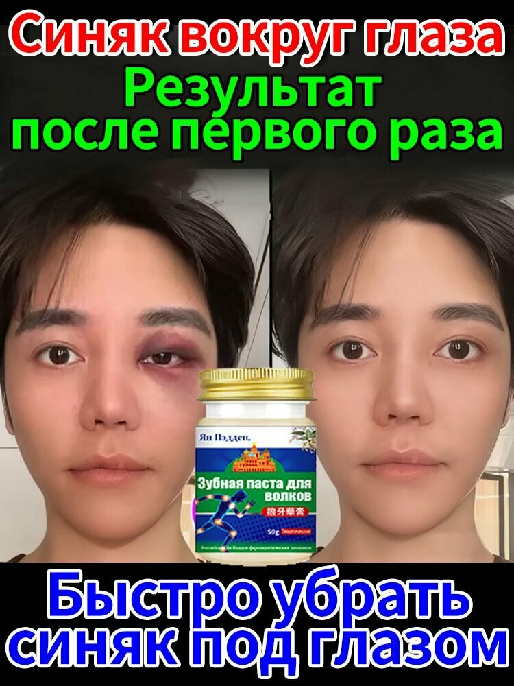 Мазь от синяков и гематом на теле