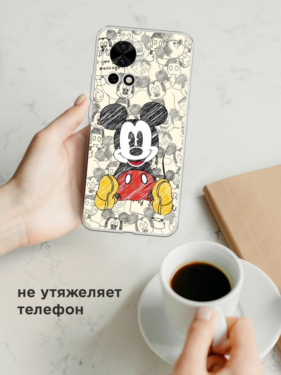 Чехол на Huawei Nova 12/Nova13 / Хуавей Нова 12/Нова 13 с принтом "Микки Маус" — фото 1