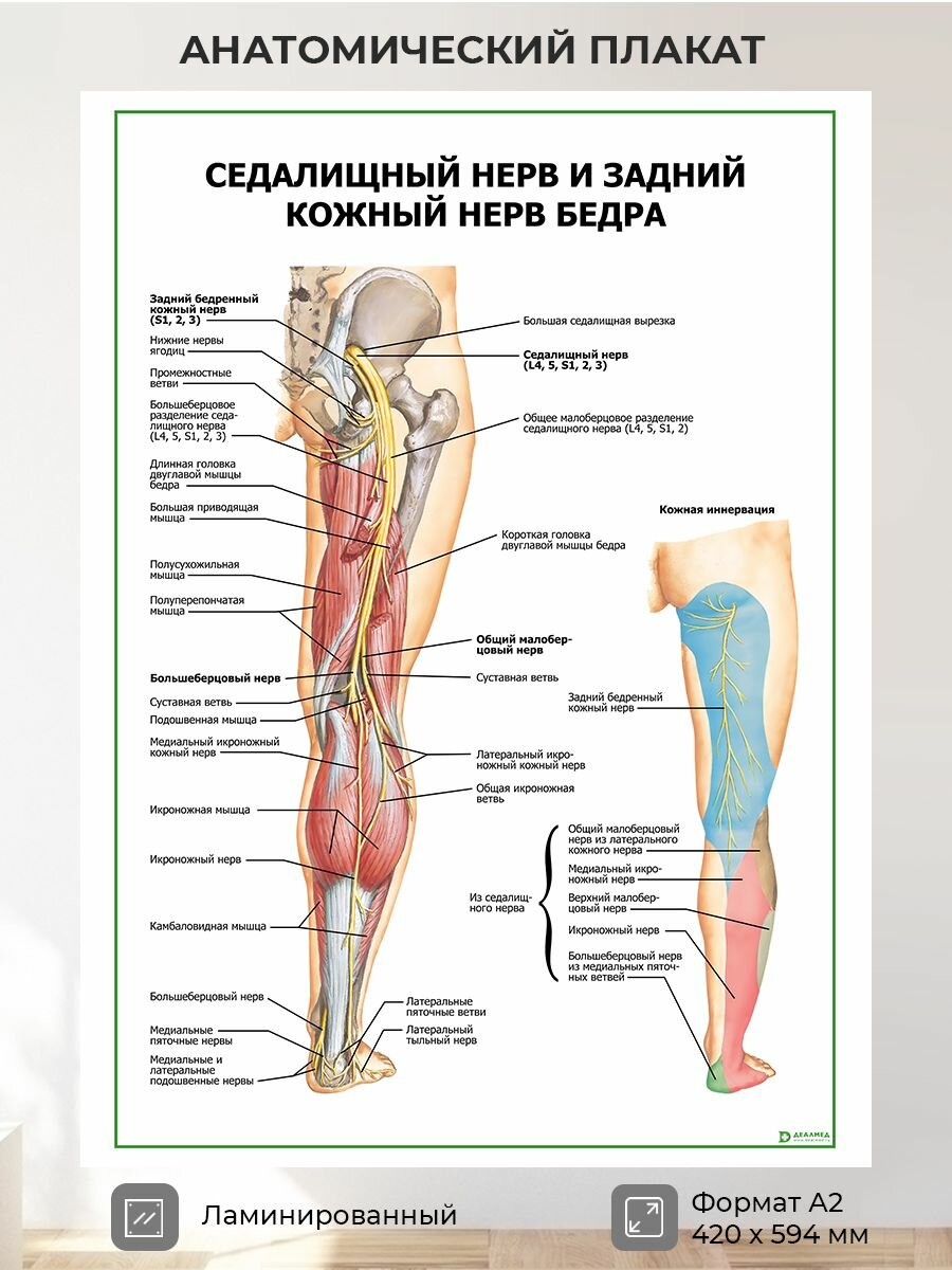 Обучающий медицинский плакат ламинированный формат А2 Седалищный нерв и задний кожный нерв бедра