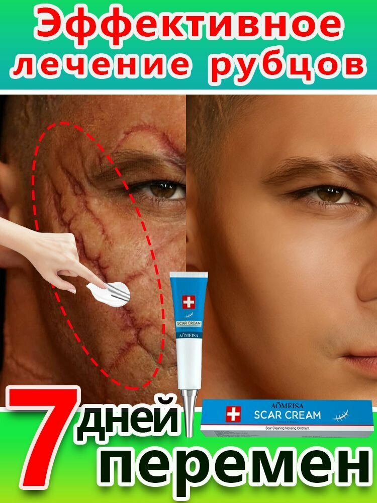 Мазь шрамов, Крем от шрамов и рубцов, следов от акне, растяжек, ожогов и послеоперационных шрамов, натуральный состав, предотвращает образование рубцов, восстанавливает кожу, 20 г