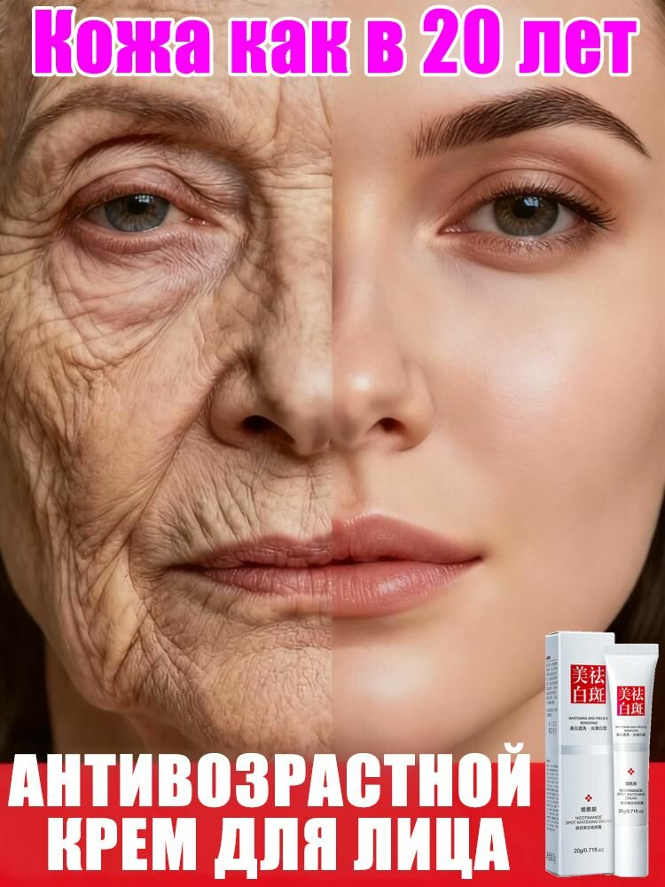 Точечный крем от прыщей, точечный крем от прыщей на лице, от прыщей и воспалений, китайская чудо-мазь, антивозрастной, против морщин, сыворотка от морщин и пигментных пятен,20 г