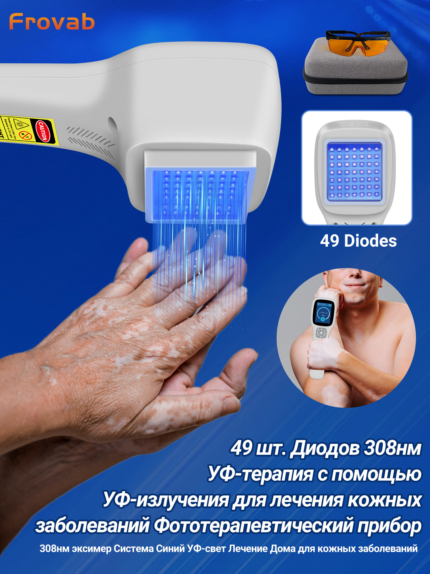 УФ-терапия Frovab 308нм 49 диода, доза 0-5 Дж/см², лечение псориаза, витилиго, дерматита и акне у взрослых