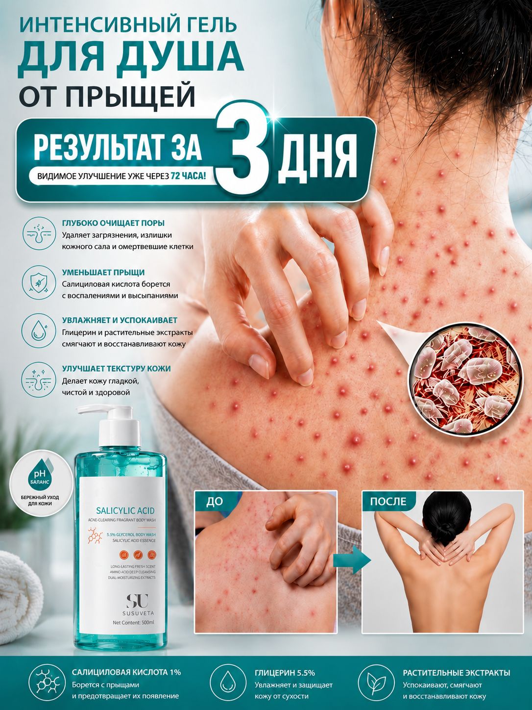 SUSUVETA 500 мл гель для душа от прыщей Борьба с акне и пигментными пятнами, глубокое очищение, антисептический эффект, подходит для проблемной кожи