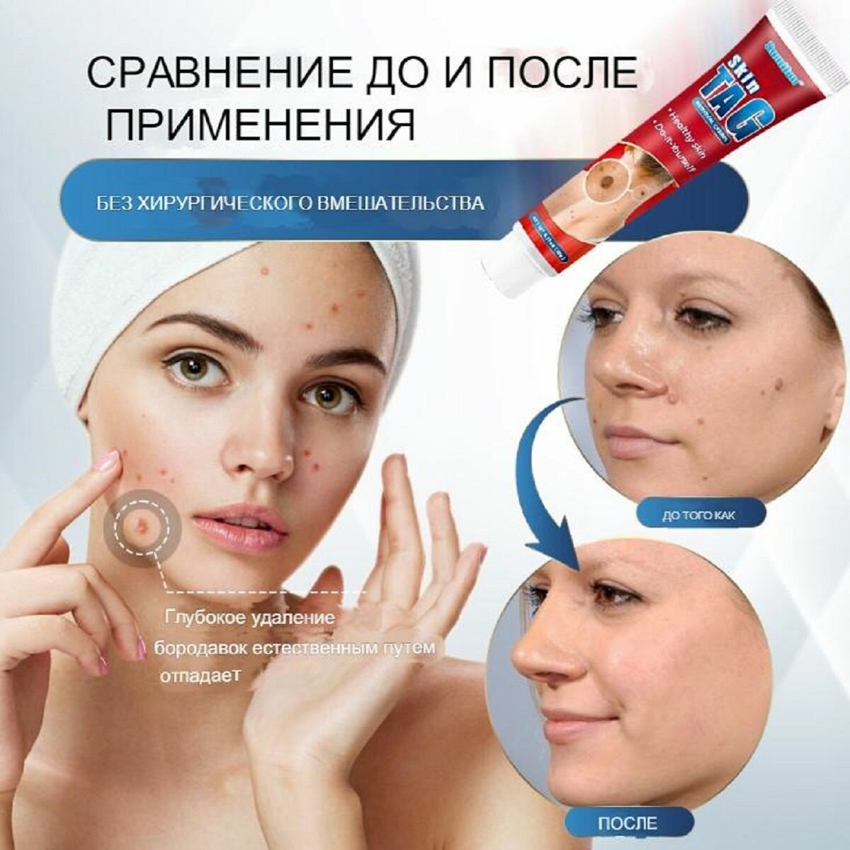 Крем от бородавок — фото 1