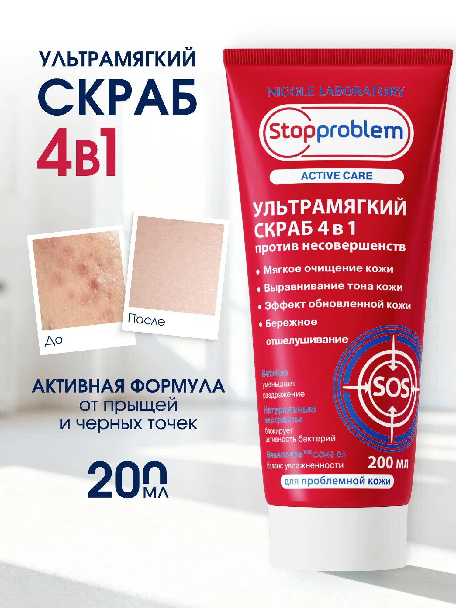 Ультрамягкий скраб 4 в 1 против несовершенств для проблемной кожи Stopproblem Active Care