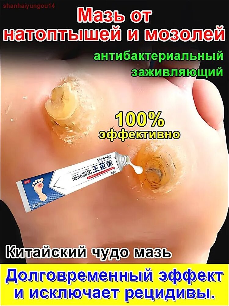 Mазь от мозолей стержневых и натоптышей , Крем от сухих мозолей, шипицы, бородавок, натоптышей,20 г.2шт