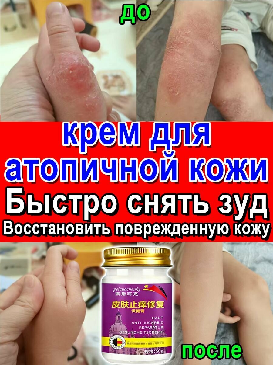 Эмульсия для атопичной кожи 50ml