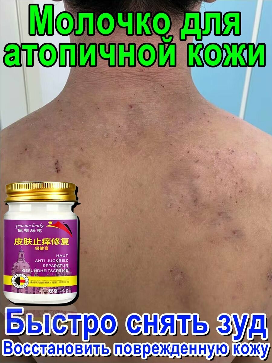 Лосьон для атопичной кожи детский