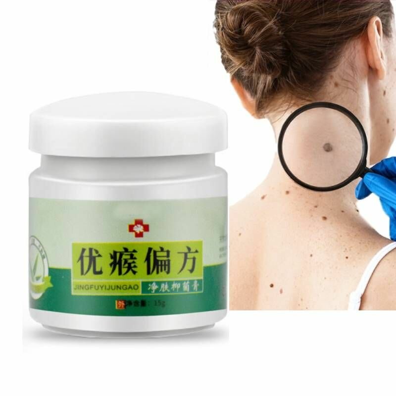 Травяная мазь для удаления родинок и бородавок