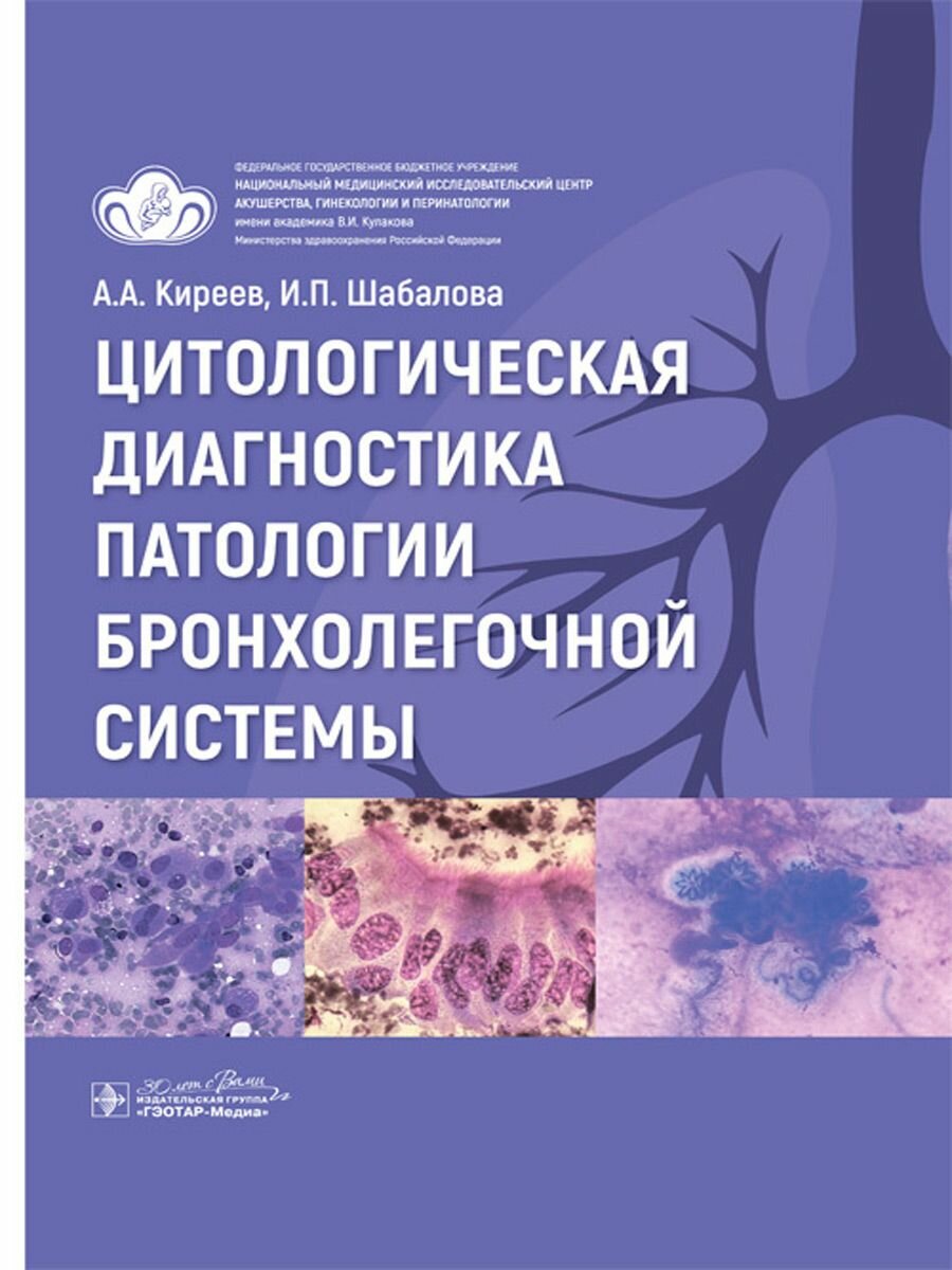 Цитологическая диагностика патологии бронхолегочной системы