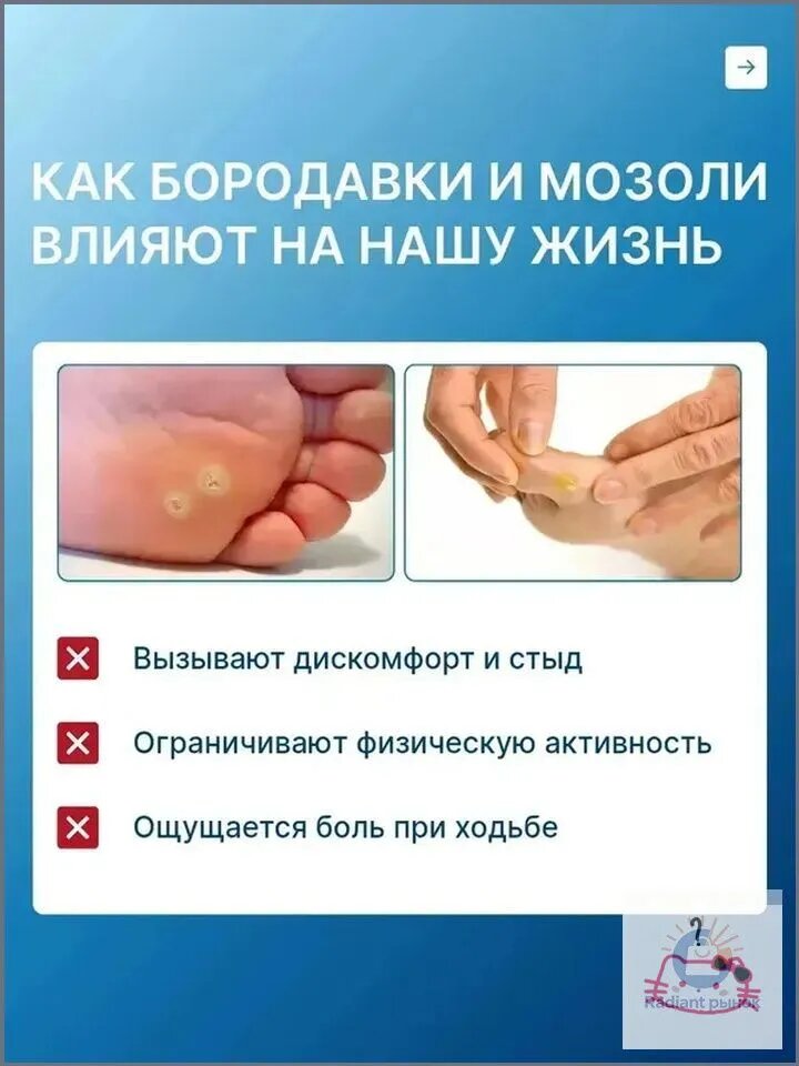 Mазь от мозолей стержневых и натоптышей , Крем от сухих мозолей, шипицы, бородавок, натоптышей,20 г.