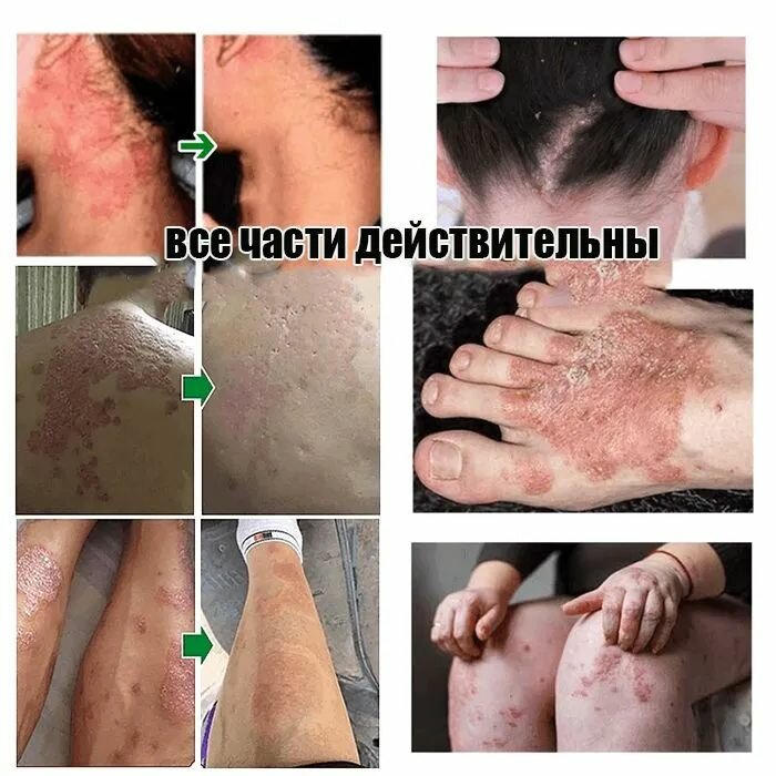 Лечебное средство — фото 1