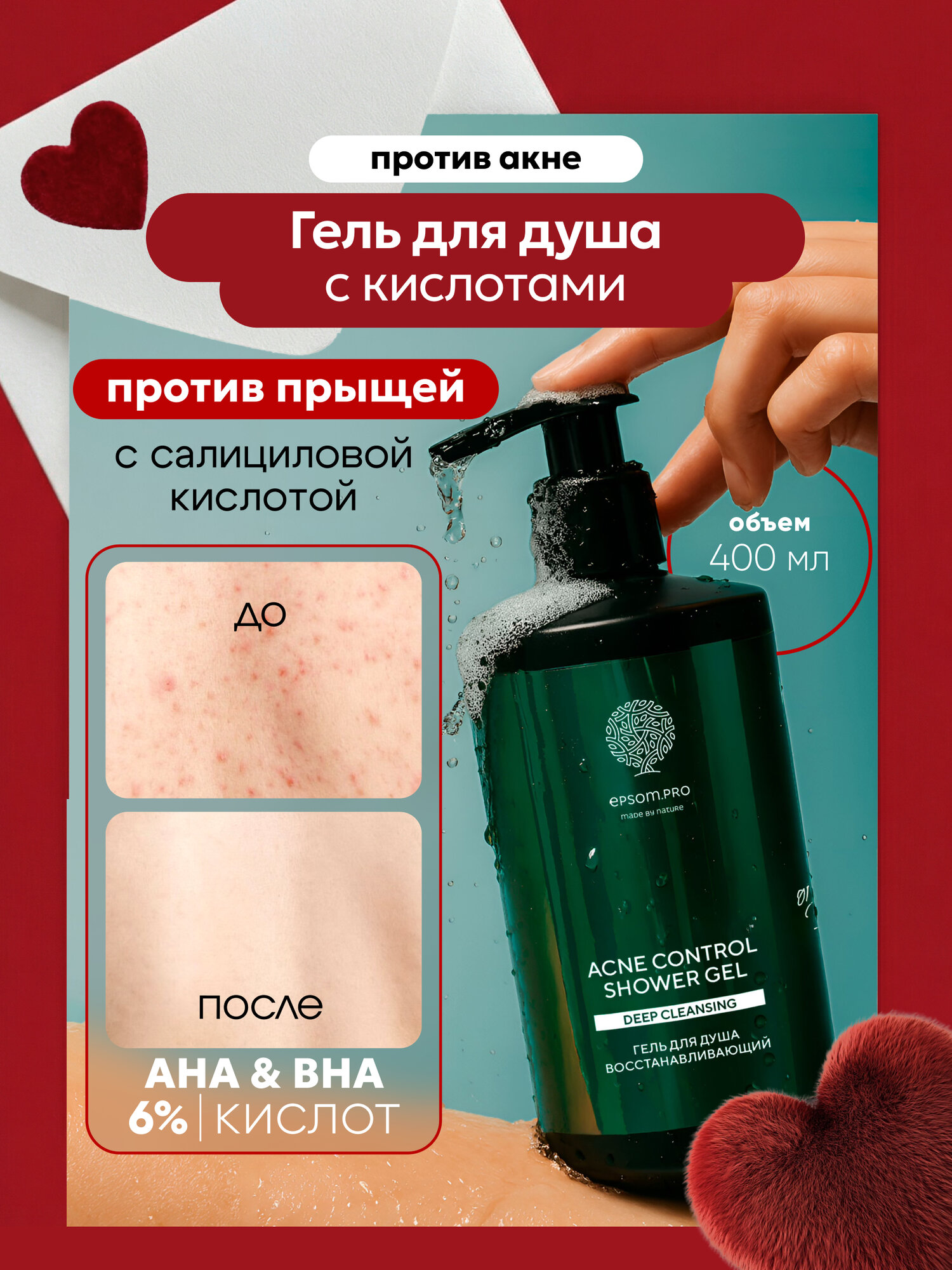 Очищающий гель для лица и тела ACNE CONTROL 6% AHA/BHA — против акне, черных точек и жирного блеска, 400 мл