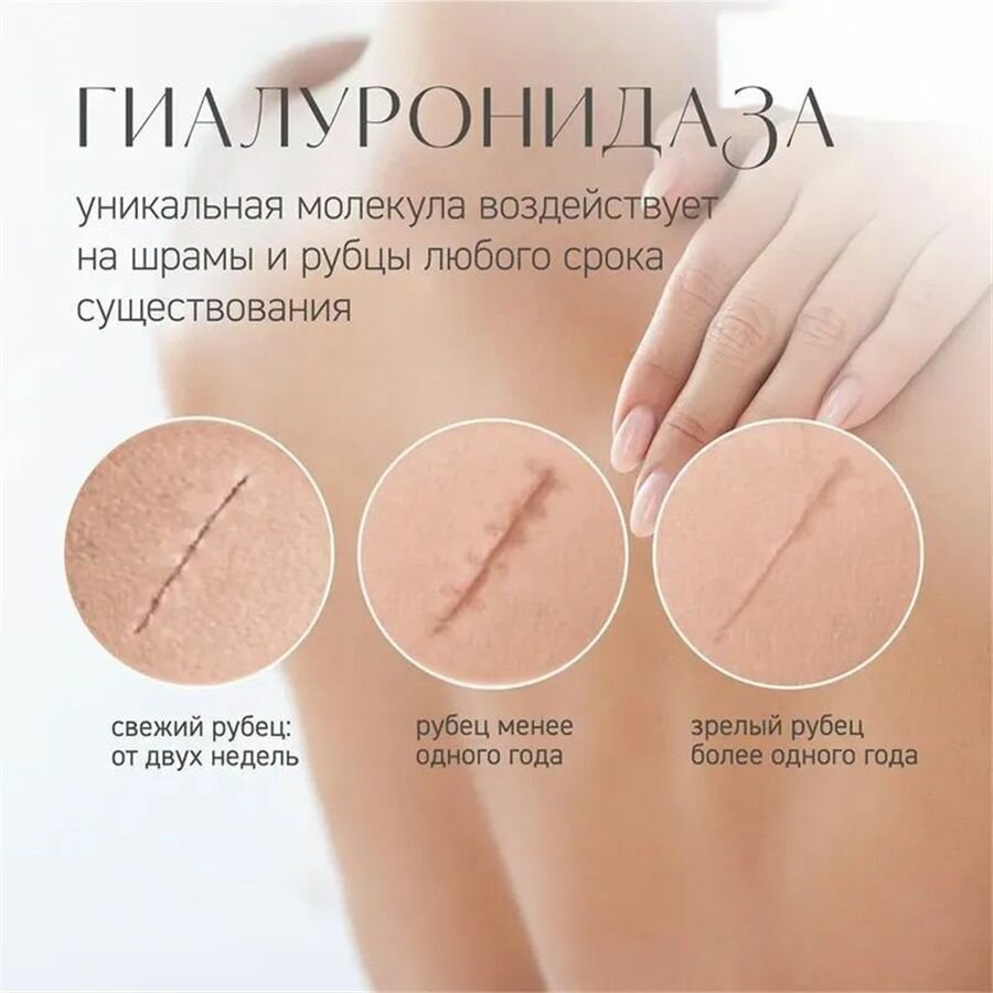 2 шт*50г Крем, который уменьшает шрамы и постепенно улучшает состояние кожи