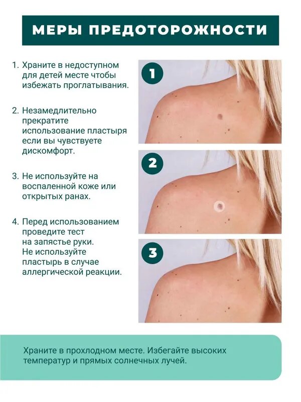 Папиллома гипс, бородавки и родинки