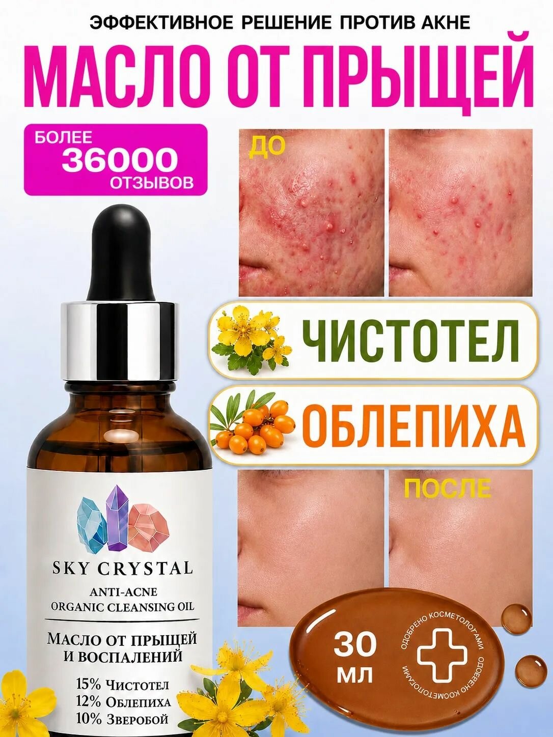 Натуральное масло сыворотка для лица от прыщей с Чистотелом 15% Облепихой 12% Зверобоем 10% и Виноградной косточкой Sky Crystal, средство от воспалений для проблемной кожи от постакне, 30 мл