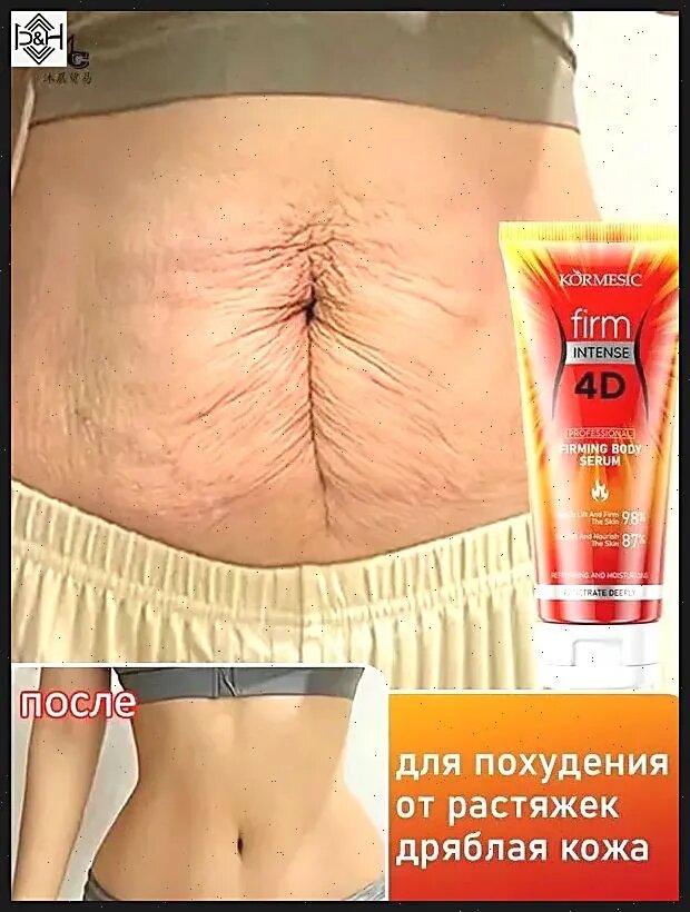 Эксклюзивный антицеллюлитный крем для моделирования тела, коррекции растяжек и упругости кожи