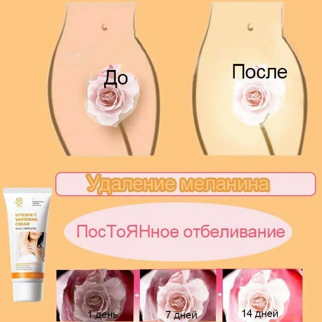 Осветляющий крем от пигментации, зоны декольте, для зоны подмышек, зоны бикини, бедер, коленей