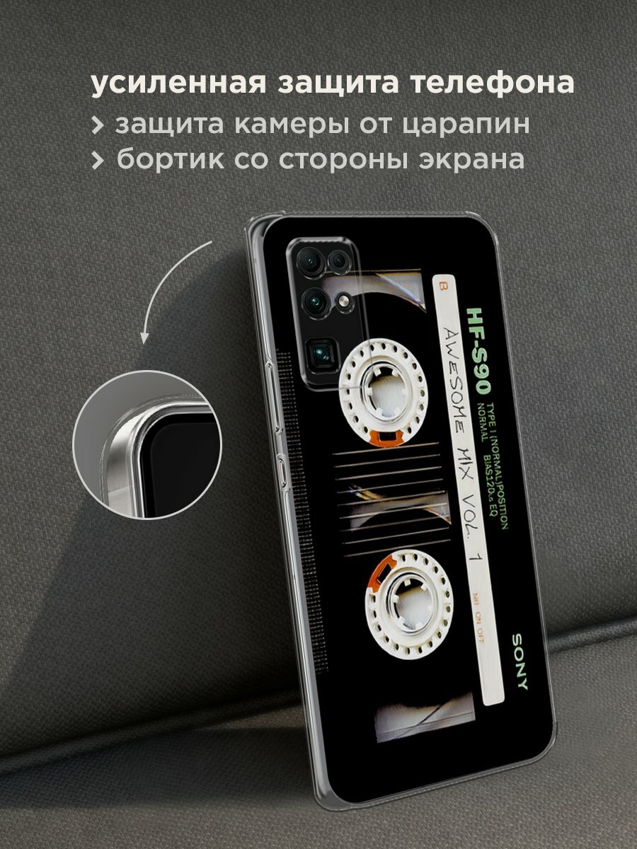 Чехол на Honor 30 / Хонор 30 с принтом "Кассета лак" — фото 1