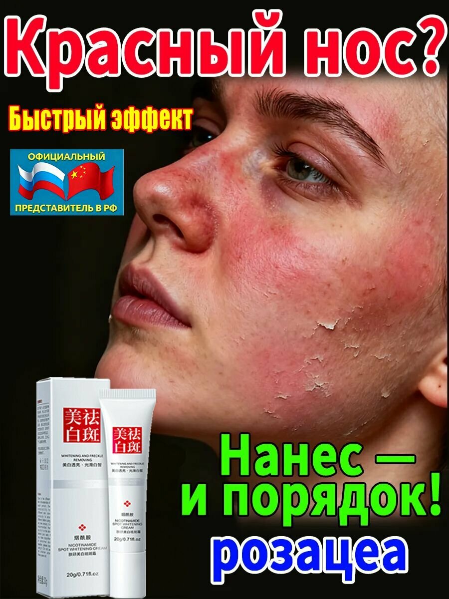 Крем от розацеа на лице купероза и покраснений 20 г, уменьшает покраснение и припухлость носа, гиперемию и жирность кожи