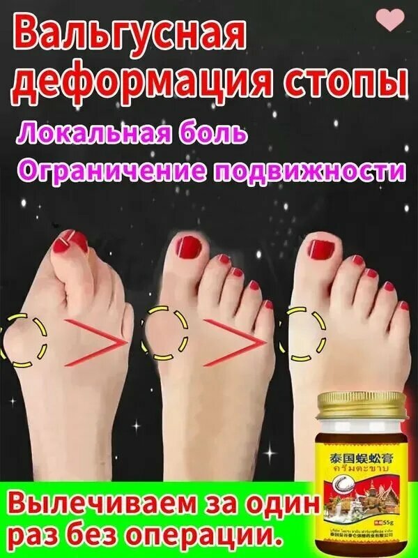 Легендарный тайский крем от косточки на ноге