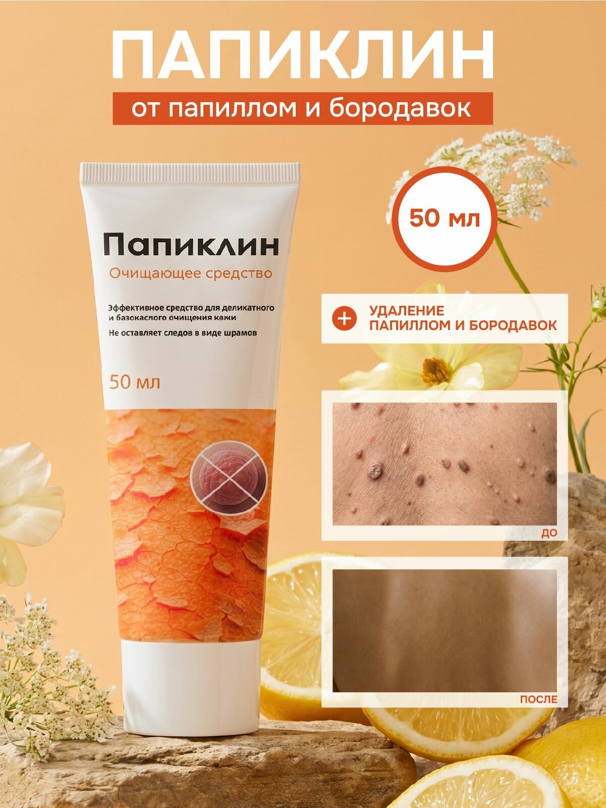 Очищающее средство от папиллом и бородавок - Папиклин