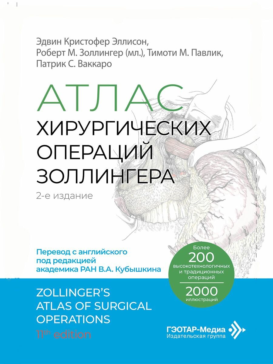 Атлас хирургических операций Золлингера