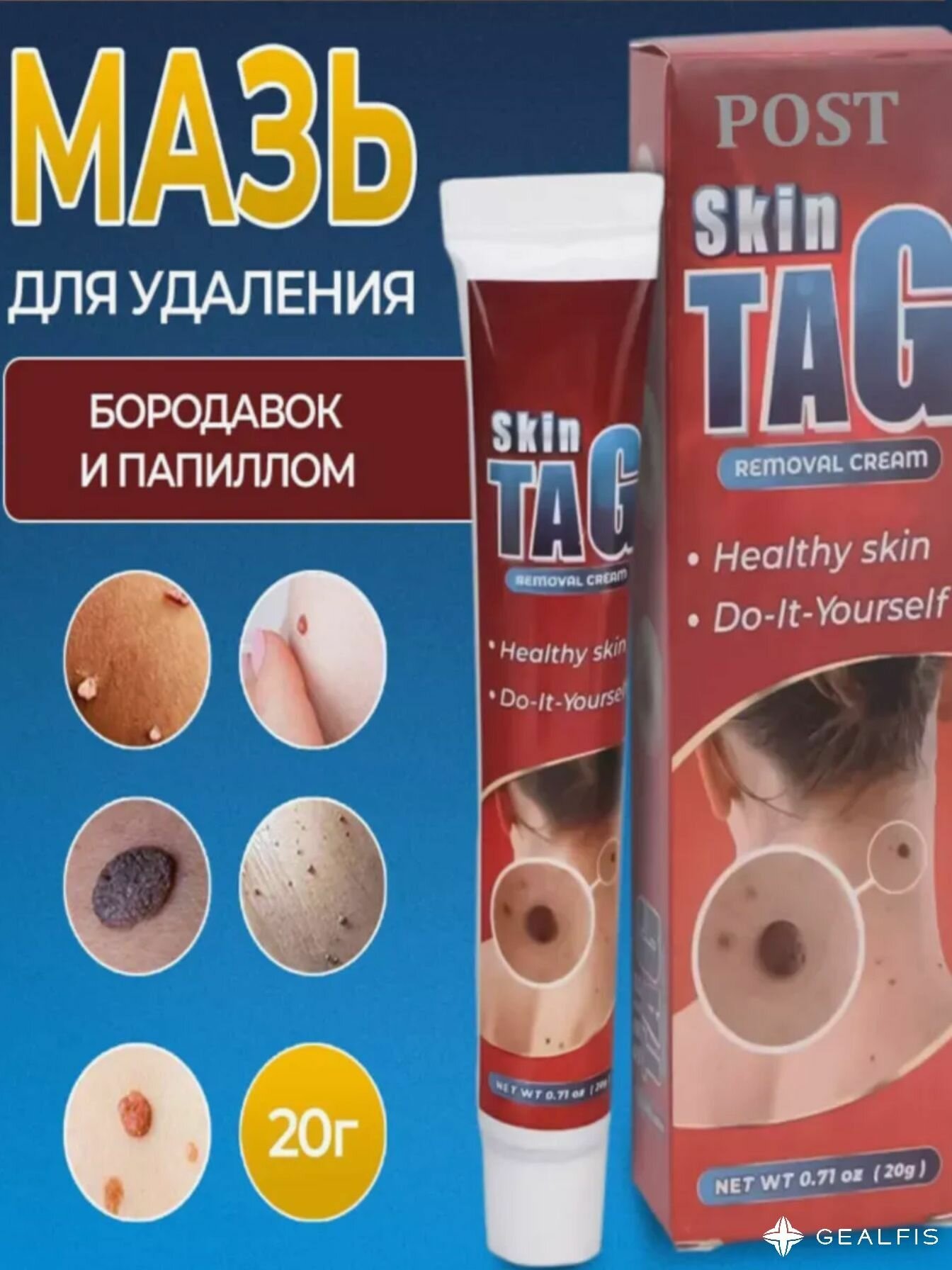 Крем мазь от папиллом и бородавок 20 г
