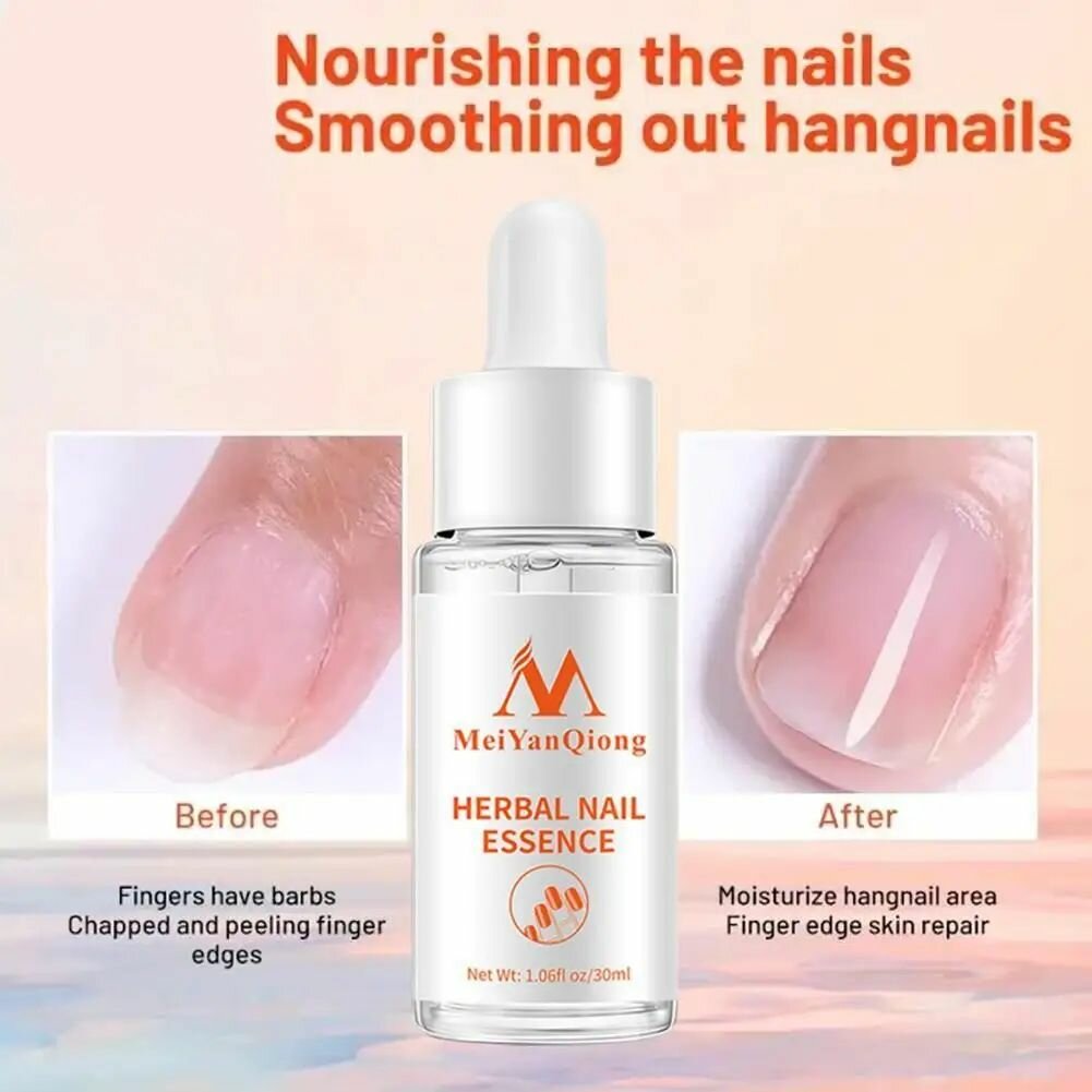 30 мл Herbal Toenail Repair Essence Эффективная сыворотка для отбеливания ногтей