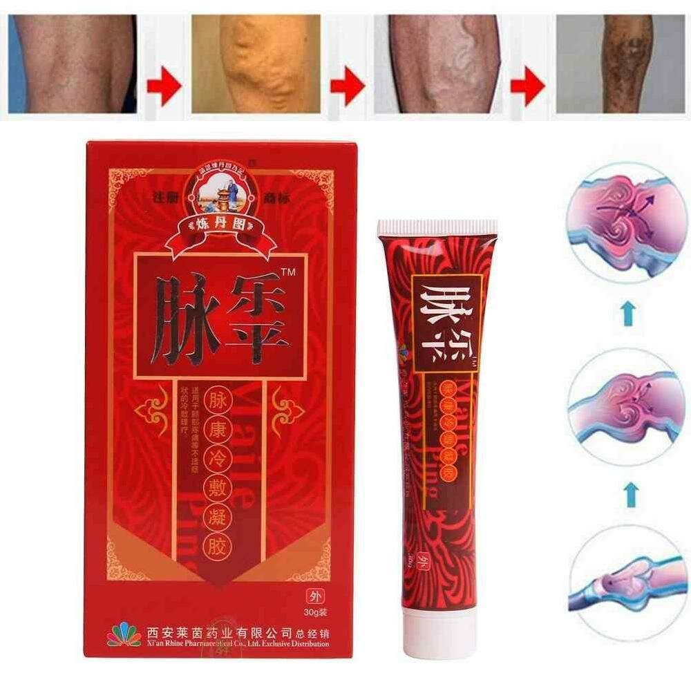 Крем для массажа при варикозном расширении вен, облегчение флебита, ангиита, воспаления кровеносных сосудов, мазь для лечения варикозного расширения вен ног с коробкой