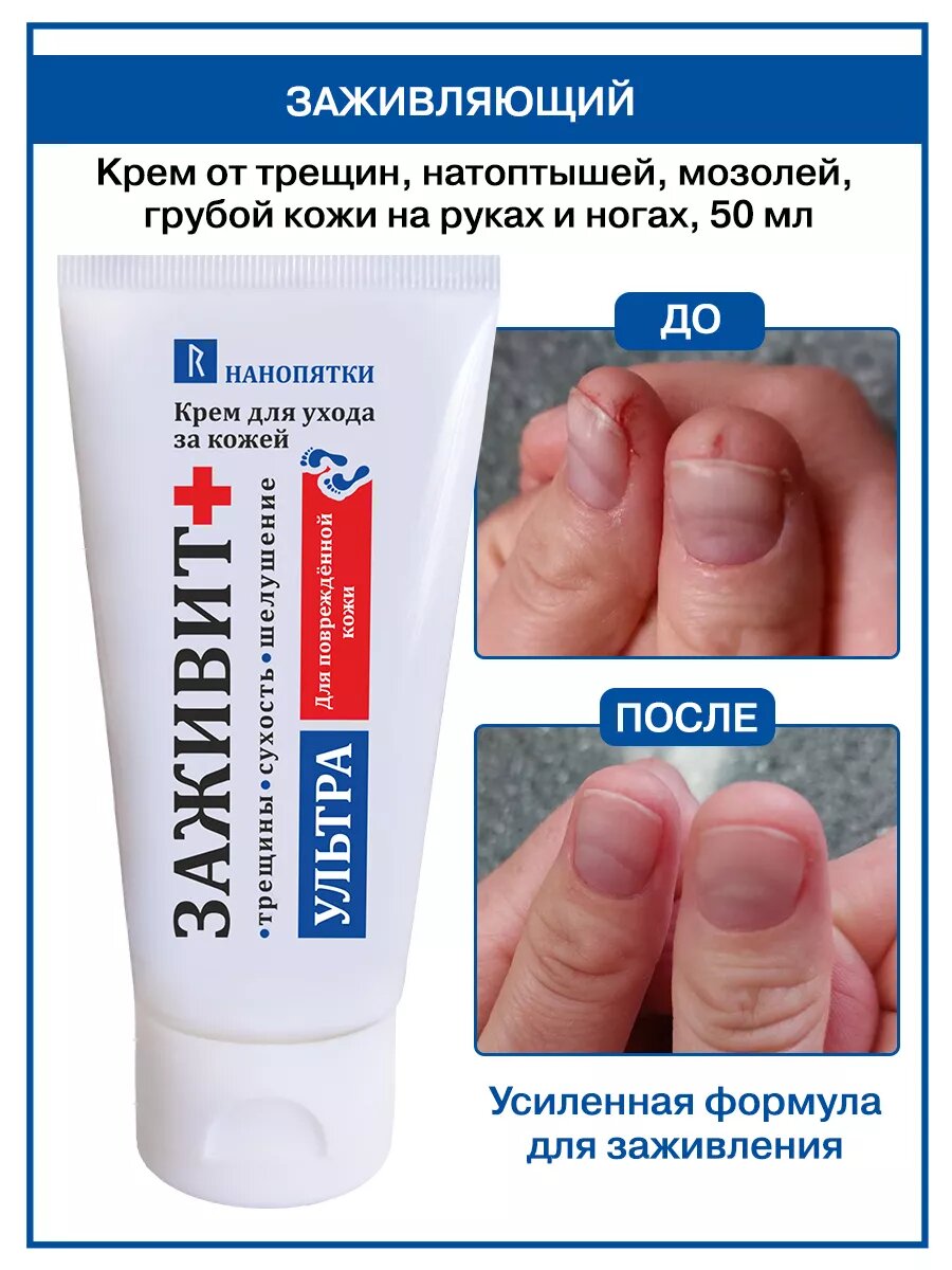 Крем от трещин заживляющий для рук и пяток